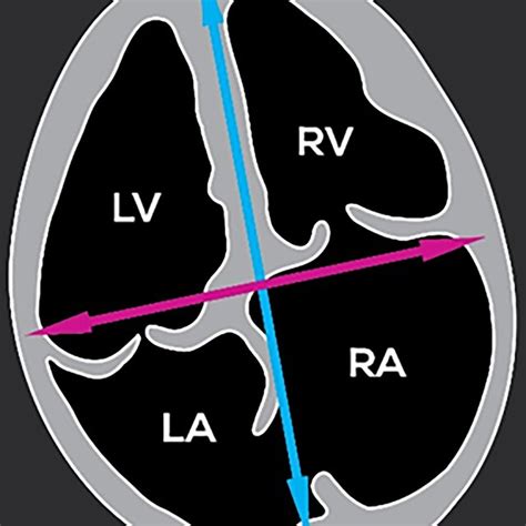 Schematic Representation Of A Longitudinal Section Of The Four Cardiac Download Scientific
