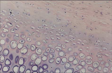 An Intact Graft With Marked Peripheral Chondrocyte Proliferation And Download Scientific