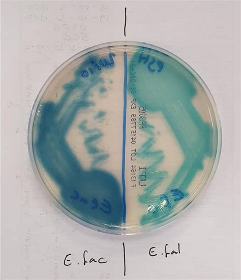 Enterococcus Sp On Uti Agar R Microbiology
