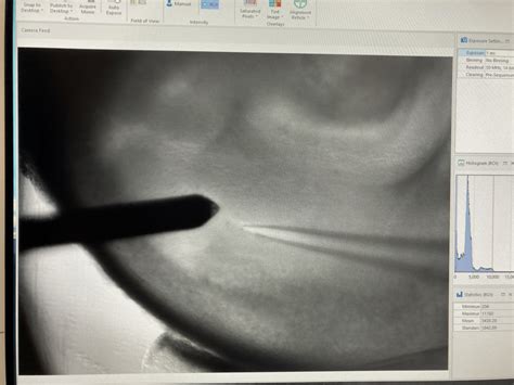 How To Detect Ltp Signal Researchgate