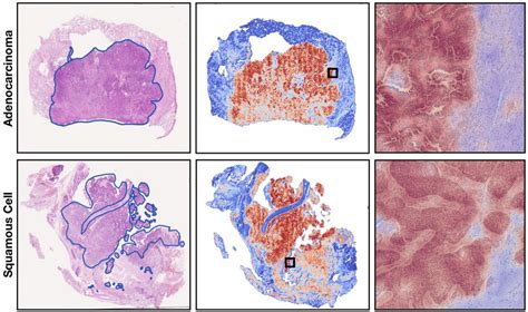 From Patches To Slides How To Train Deep Learning Models On Gigapixel Images With Weak