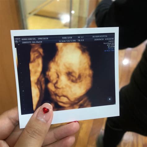 월재일기임신24주~임신27주 임신7개월임당검사입체초음파정밀초음파재검 네이버 블로그