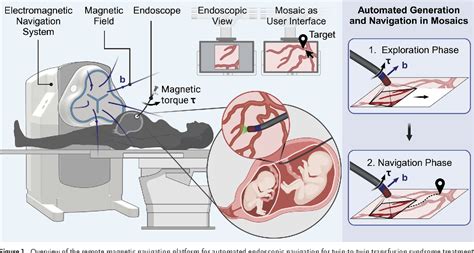 Figure 1 From Autonomous Magnetic Navigation In Endoscopic Image Mosaics Semantic Scholar