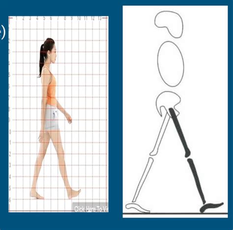 Gait Practical Flashcards Quizlet