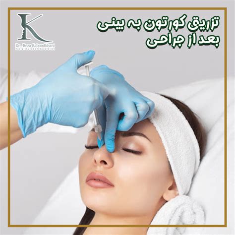 تزریق کورتون بعد از جراحی بینی مزایا آمپول کورتون دکتر کبودخانی
