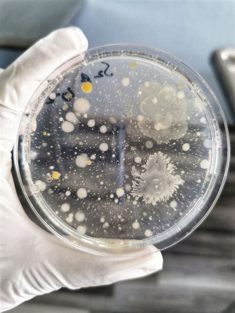 Bacteria On Plate Count Agar Stock Photo Image Of Biology Colony 298101248