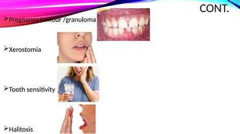 Impact Of Periodontal Infection On Pregnancypptx