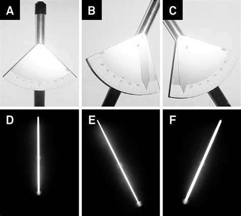 A Disturbed Processing Of Graviceptive Pathways May Be Involved In The