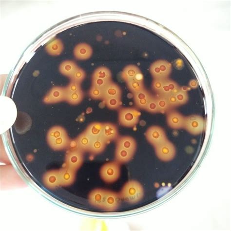 Amylase Production In Starch Agar Medium In 2025 Food Enzymes Canning