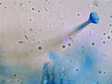 Fun With Microbiology Whats Buggin You Apophysomyces Elegans Complex