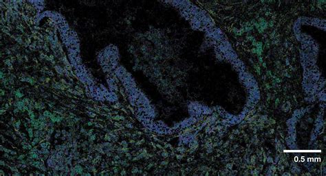 Cosmx Smi Overview Single Cell Imaging Nanostring