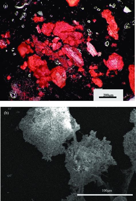 Micrographs Without Iron Reducing Bacteria A Digital Micrographs