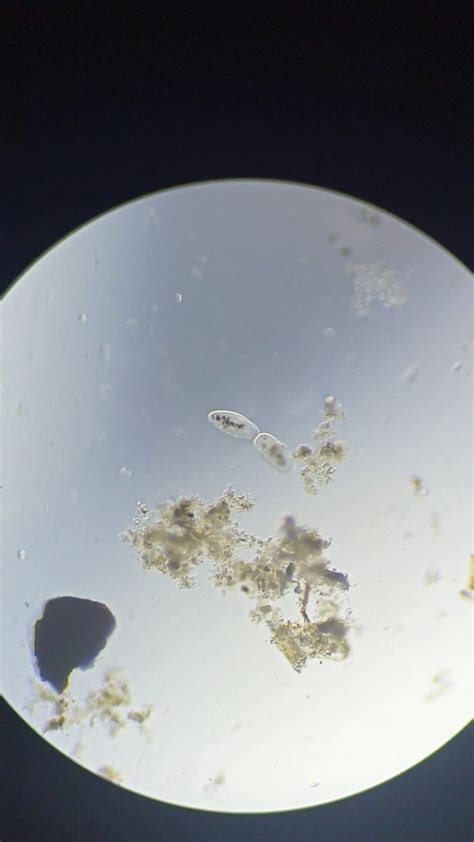 Binary Fission R Microscopy