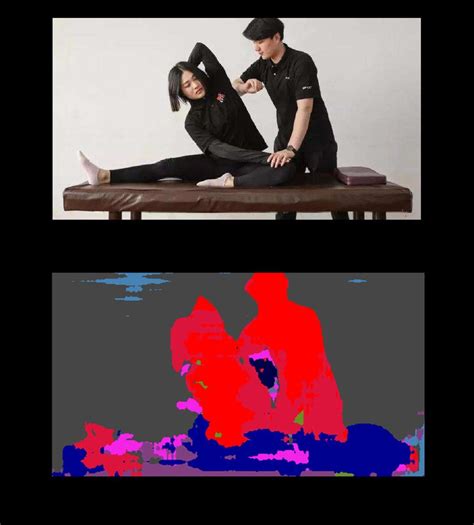 example of medical image segmentation based on deep learning algorithm