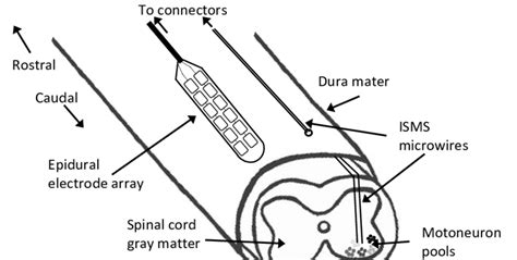 Cross Section Of The Lumbosacral Enlargement Of The Spinal Cord An