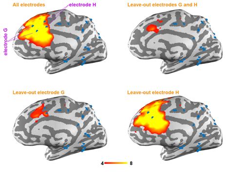 Distributed Source Modeling Of Seeg Recording Of Ictal Activity
