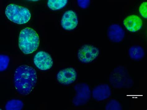 Cellbiologie Brdu Dna Flowcytometry Hts Imaging