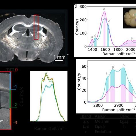 a wide field image of a brain slice with the tf track b close up of