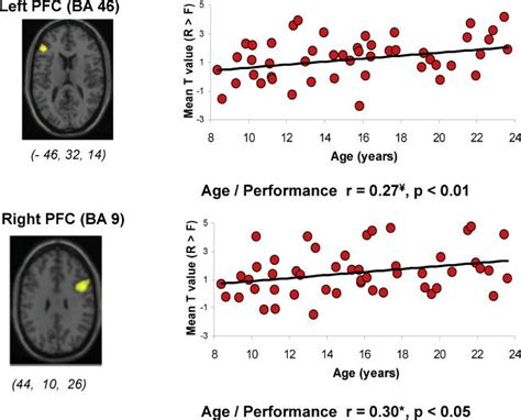 age related differences in activation during encoding in bilateral