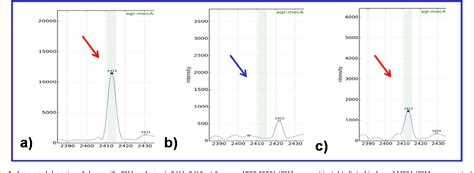 Figure 1 From Maldi Tof Bacterial Subtyping To Detect Antibiotic Resistance Semantic Scholar