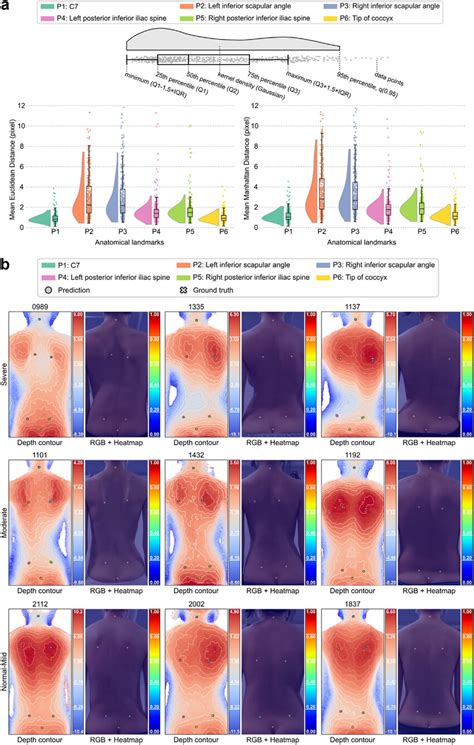 Statistical Analysis And Visual Results Of The Landmarks Detection On