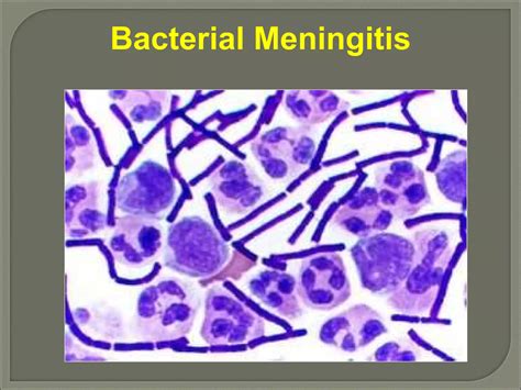 Csf Analysis Presentation Ppt