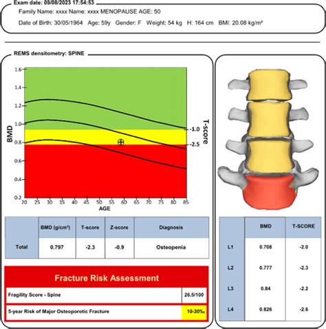 Radiofrequency Echographic Multi Spectrometry Rems In The Diagnosis