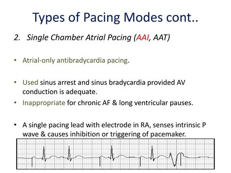 Ppt Anesthetic Considerations In Patients With Cardiac Pacemaker Powerpoint Presentation