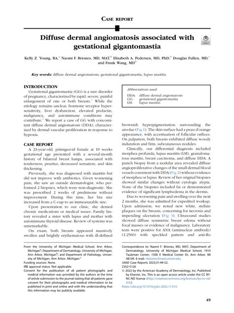 PDF Diffuse Dermal Angiomatosis Associated With Gestational Gigantomastia