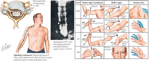 Neck Injuries Clinical Tree