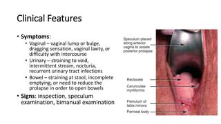Pelvic Organ Prolapse Pptx