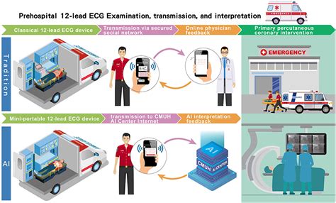 Frontiers Artificial Intelligence Assisted Remote Detection Of St Elevation Myocardial
