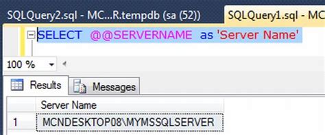 Global Variables In SQL Server