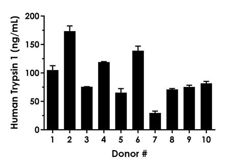 Human Trypsin 1 Elisa Kit Ab317772 アブカム