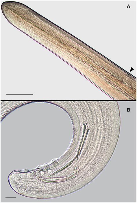 Adult Dirofilaria Immitis Anterior Extremity Of The Female A Download Scientific Diagram
