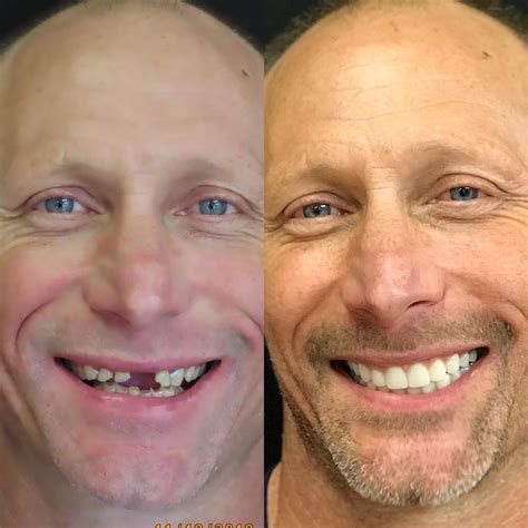 David W Epstein Dds Inc Cosmetic Implant And Reconstructive Dentistry Updated David W