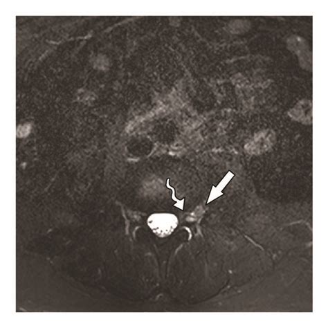 65 Year Old Male Admitted To The Emergency Room With History Of Sudden Download Scientific