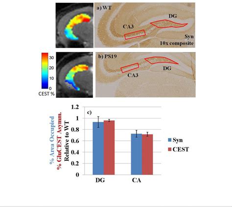 Comparison Of Glucest With Synapse Immunostaining In Sub Regions Of The Download Scientific