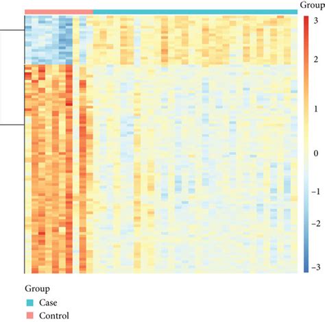 DEGs Between SONFH Patients And Control Samples A Volcano Plot