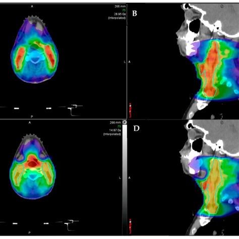 Example Comparison Between Step And Shoot Intensity Modulated Download Scientific Diagram