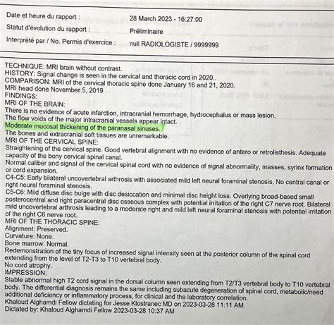 Neupogen Injections Rmultiplemyeloma