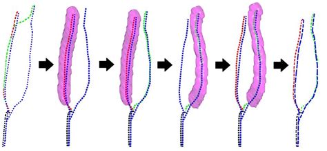2 Schematic Showing The Cooperative Centerline Extraction Method Blue