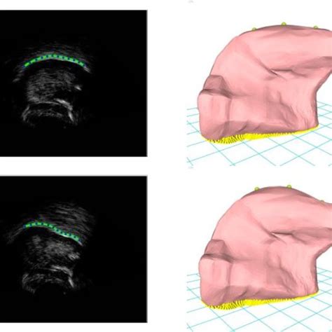 Sample Frames Of 3d Tongue Modeling The Ultrasound Images Are Given In Download Scientific