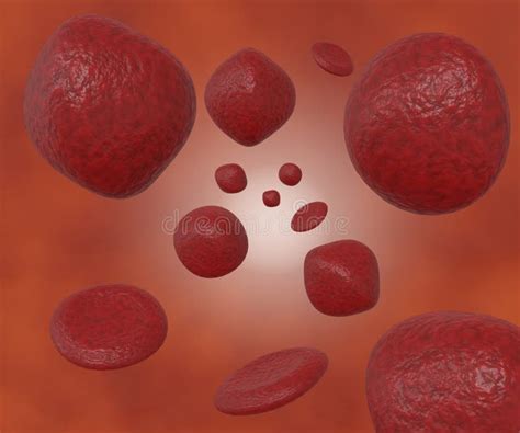 Macrocytosis Is A Condition In Which Your Red Blood Cells Are Larger Than They Should Be Stock Macrocytosis Is A Condition In Which Your Red Blood Cells Are Larger Than They Should Be Stock