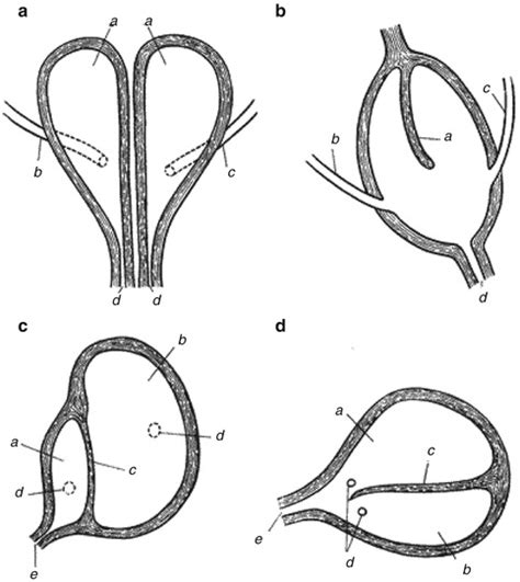 Diagnostic Imaging Of Urinary Bladder Diverticula Radiology Key
