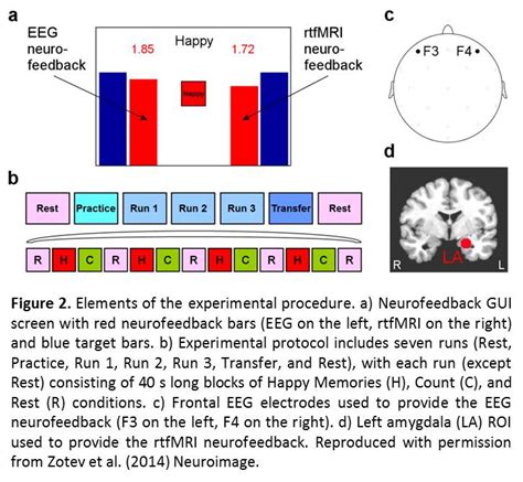 Integration Of Concurrent Real Time Fmri And Eeg Data