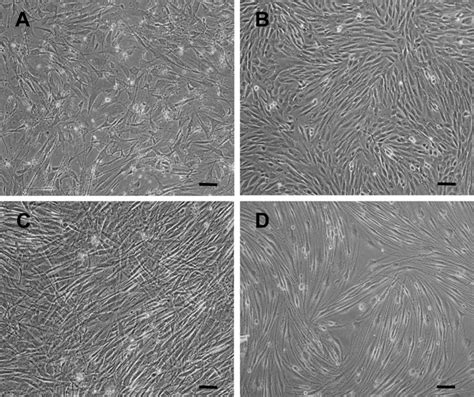 What Are Feeder Layers At Wayne Tisdale Blog