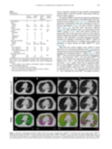 SOLUTION Parametric Response Mapping As An Indicator Of Bronchiolitis Obliterans Syndrome After