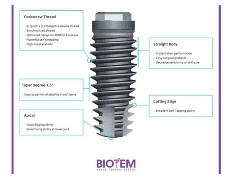 بهترین برند ایمپلنت کره ای چیست؟ معرفی انواع ایمپلنت کره ای