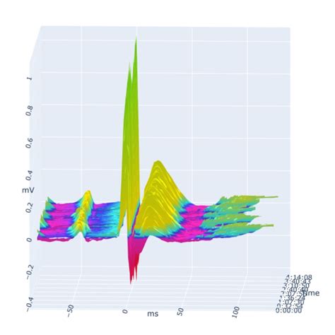 lasa ecg delineation analyzer module